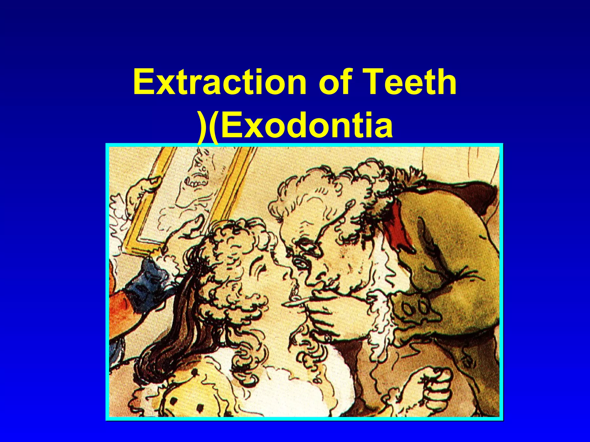 Exodontia | PPT