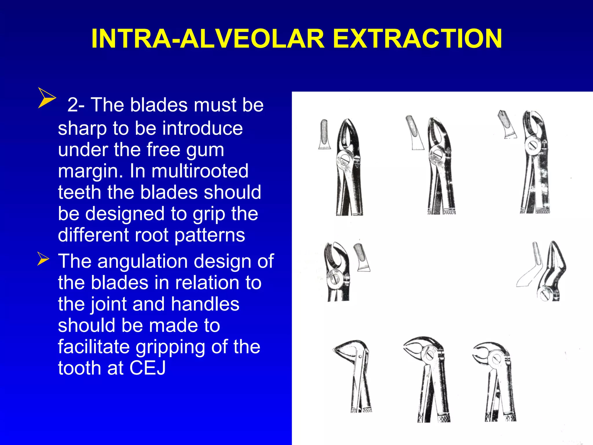 Exodontia | PPT