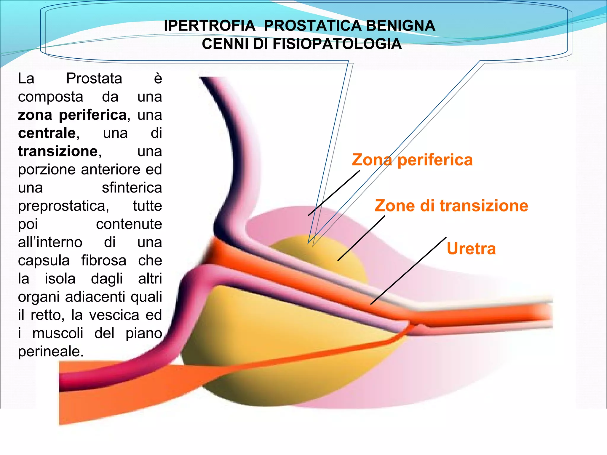 Prostata, psa plasmatico, fisiopatologia, terapia | PPT
