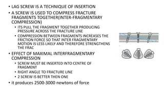 LAG SCREW PRINCIPLES.ppt