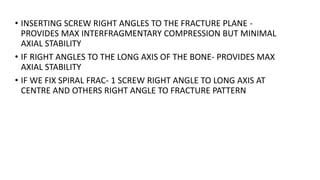 LAG SCREW PRINCIPLES.ppt
