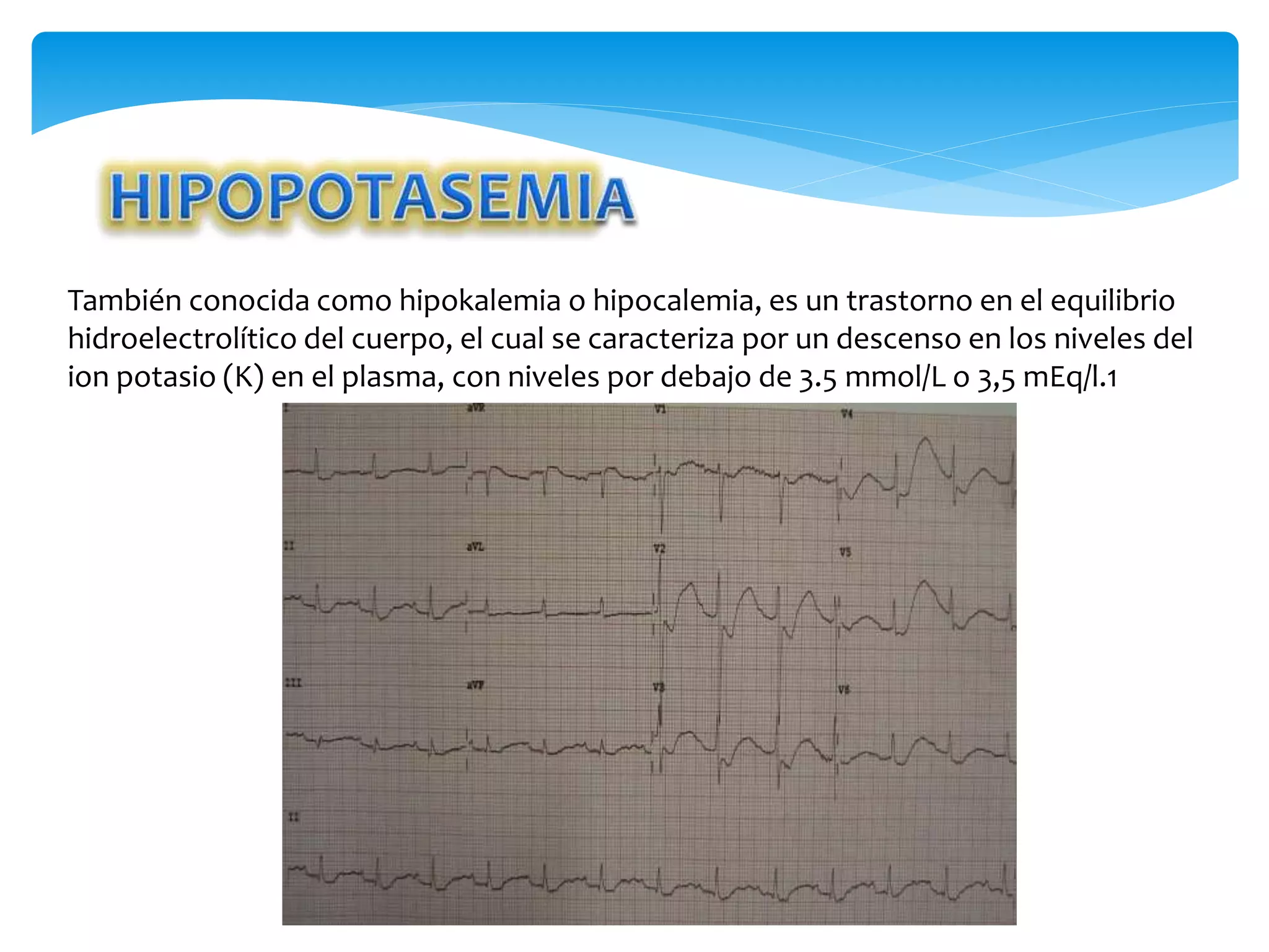 LA HIPOPOTAMISEMIA Y LA HIPERPOTAMISEMIA ES.pptx