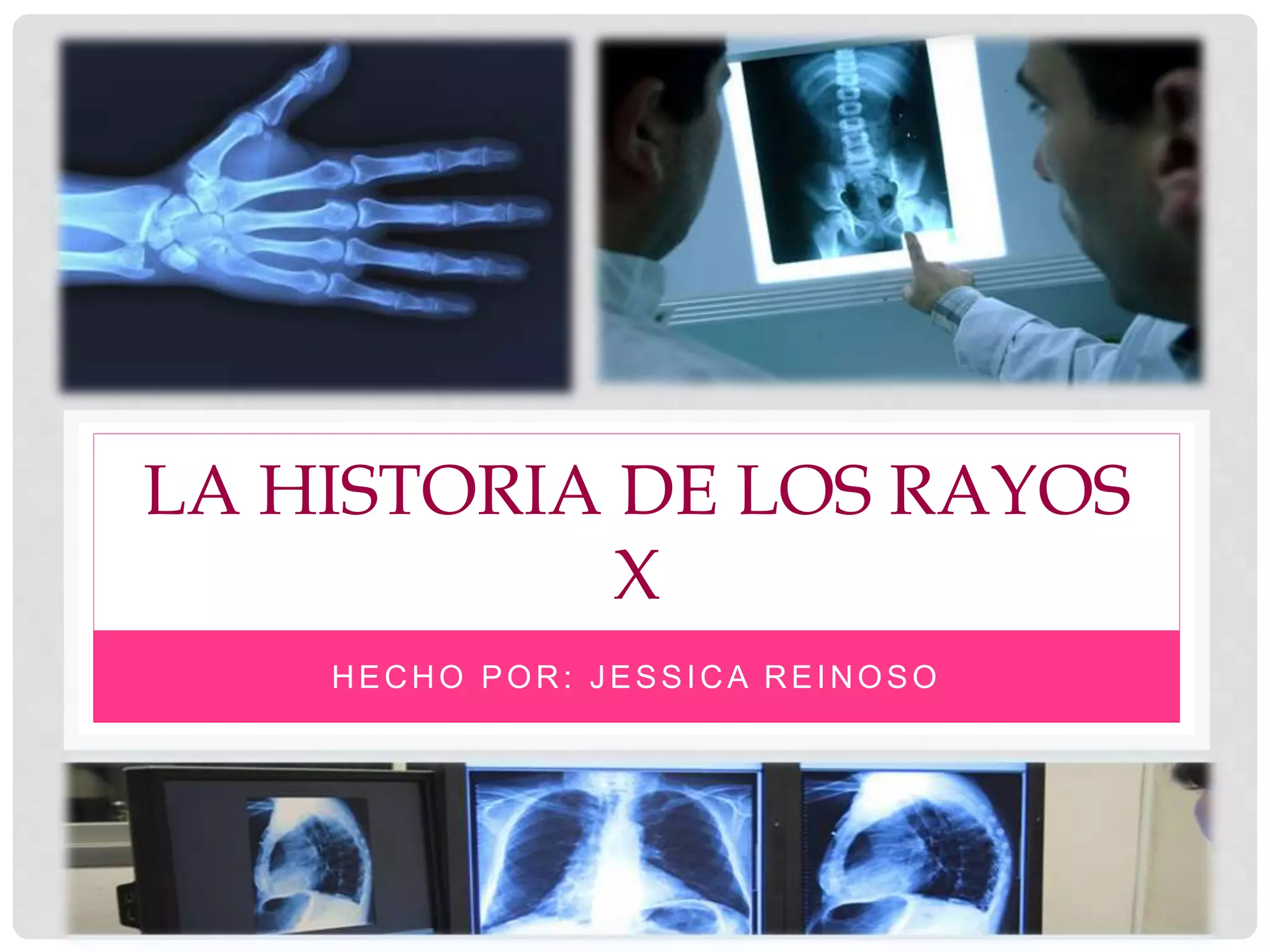HISTORIA DE LOS RAYOS X | PPT