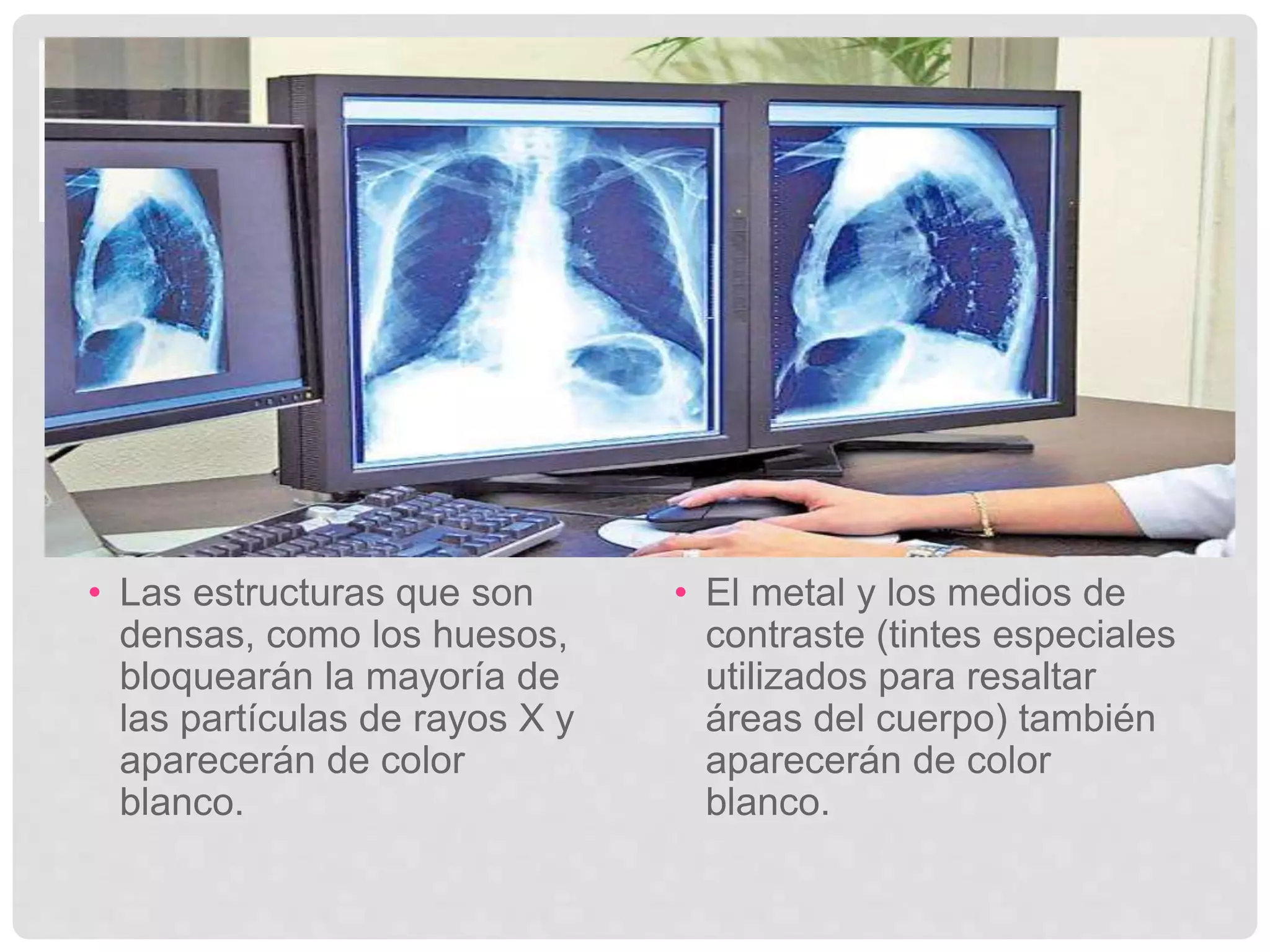 HISTORIA DE LOS RAYOS X | PPT