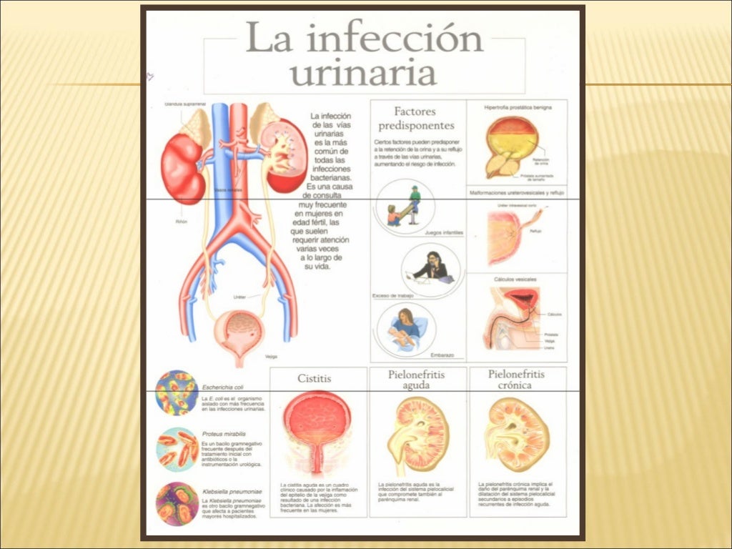 La infeccion urinaria