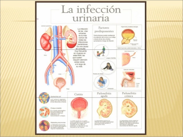 ¿Qué Es Y Por Qué Se Produce La Infección Urinaria? – QIZR