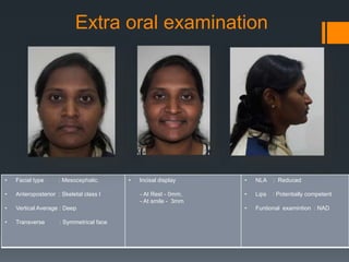 Retained lateral incisor, reduce tooth show on smile | PPT