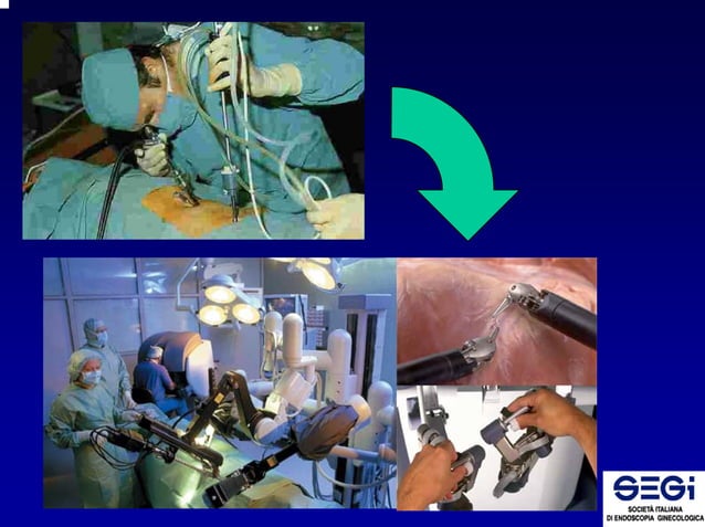 La laparoscopia diagnostica | PPT