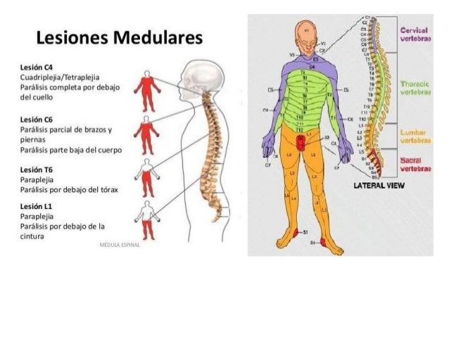 Lesión Médula Espinal: Definición, Casos Clínicos Y Rehabilitación – PJLM