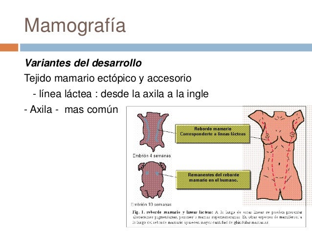 La mama en imagen (1)