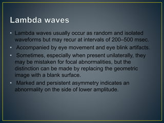 Lambda waves | PPTX
