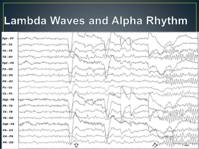Lambda waves