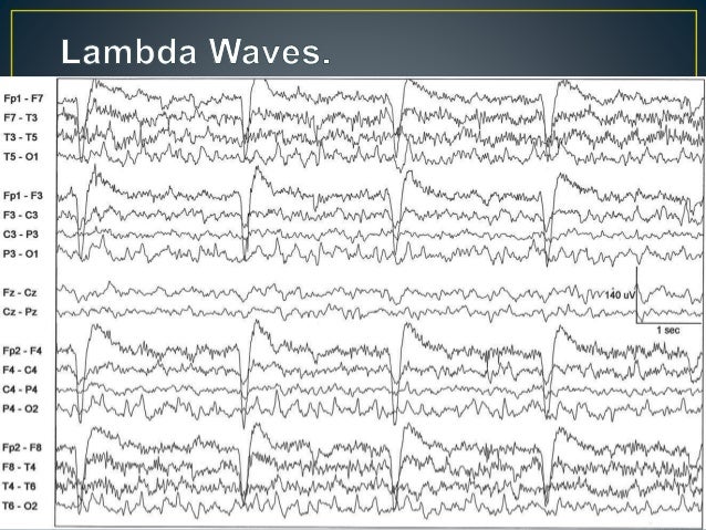 Lambda waves