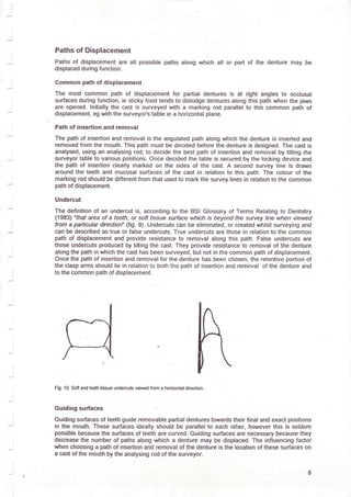 Lambeth college removable partial dentures | PDF