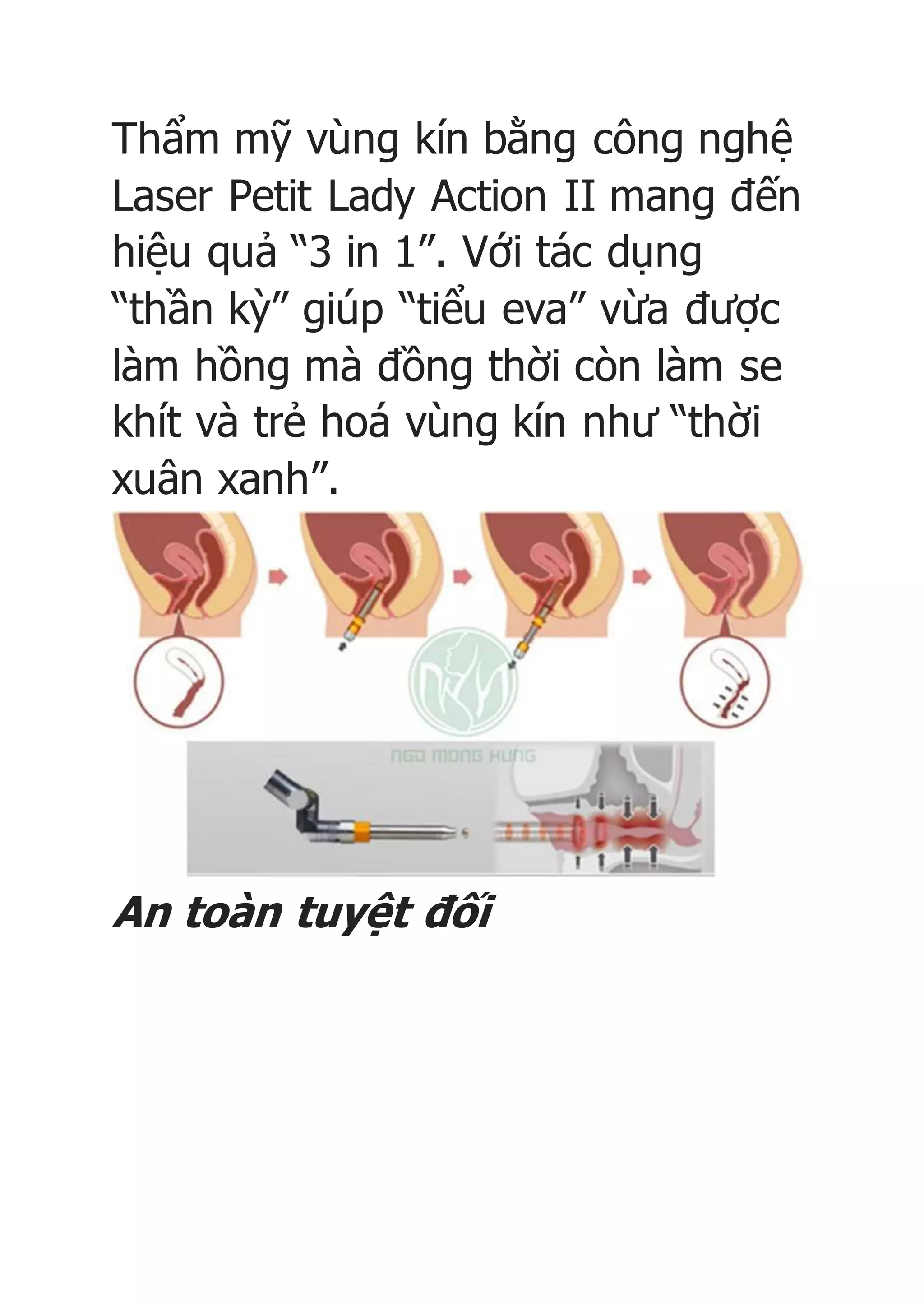 Lam dep vung kin nhu the nao | PDF