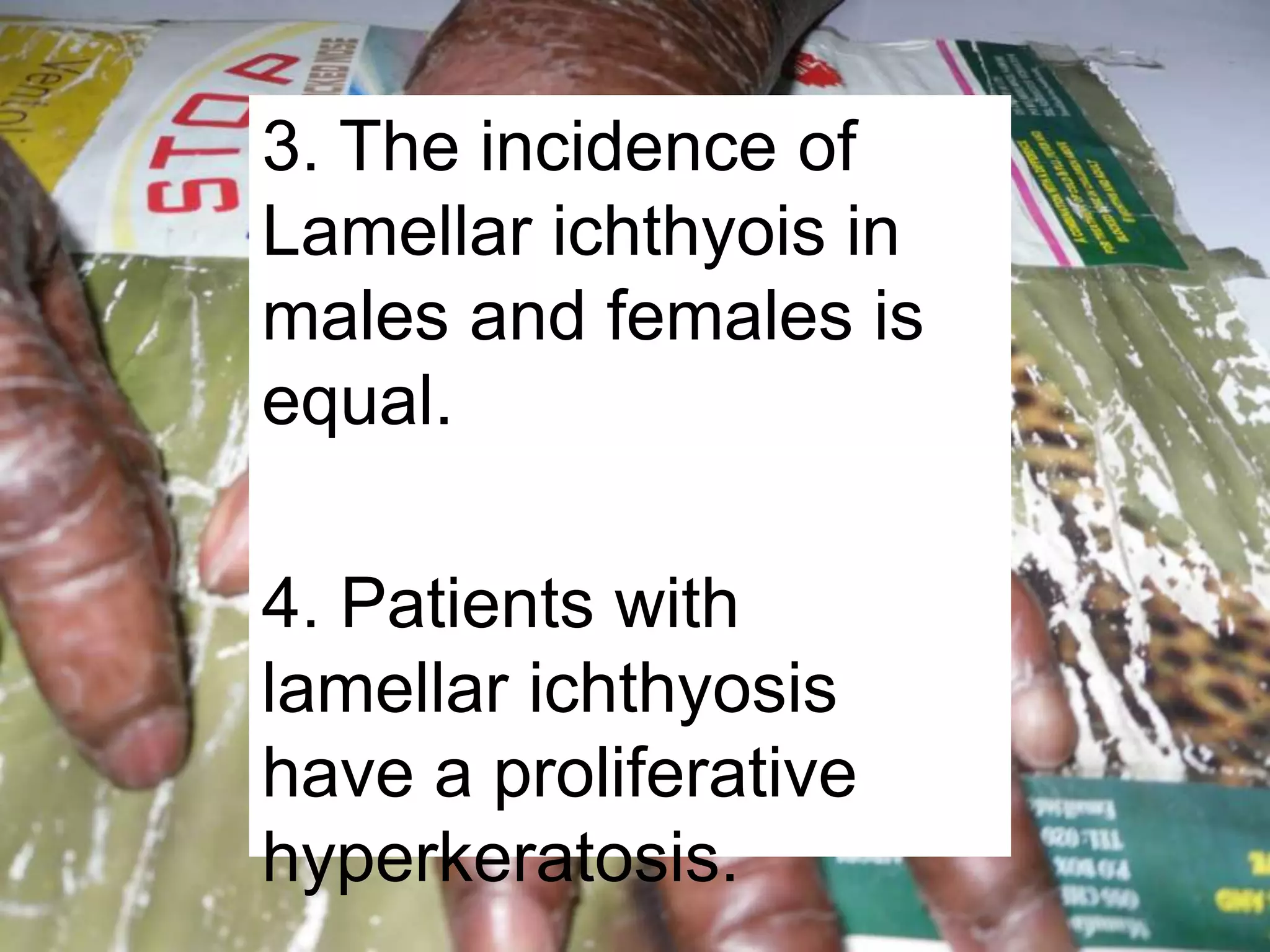 Lamellar ichthyosis | PPTX