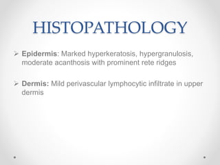 Lamellar ichthyosis: Discussion | PPTX