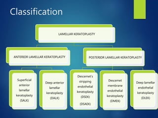 Lamellar keratoplasty | PPT