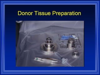 Lamellar surgery | PPT