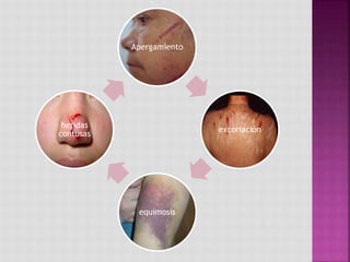 Lamina lesionologia medicina legal | PPTX