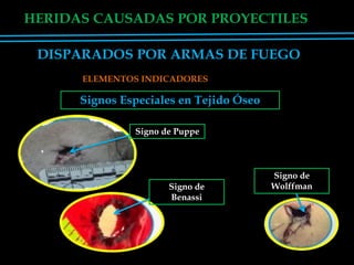 Laminas 10%lesiones | PPTX