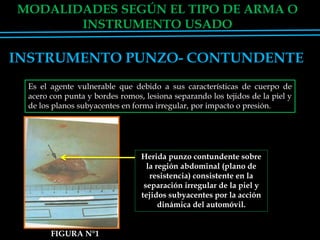 Laminas 10%lesiones | PPT