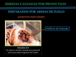 Laminas 10%lesiones | PPT