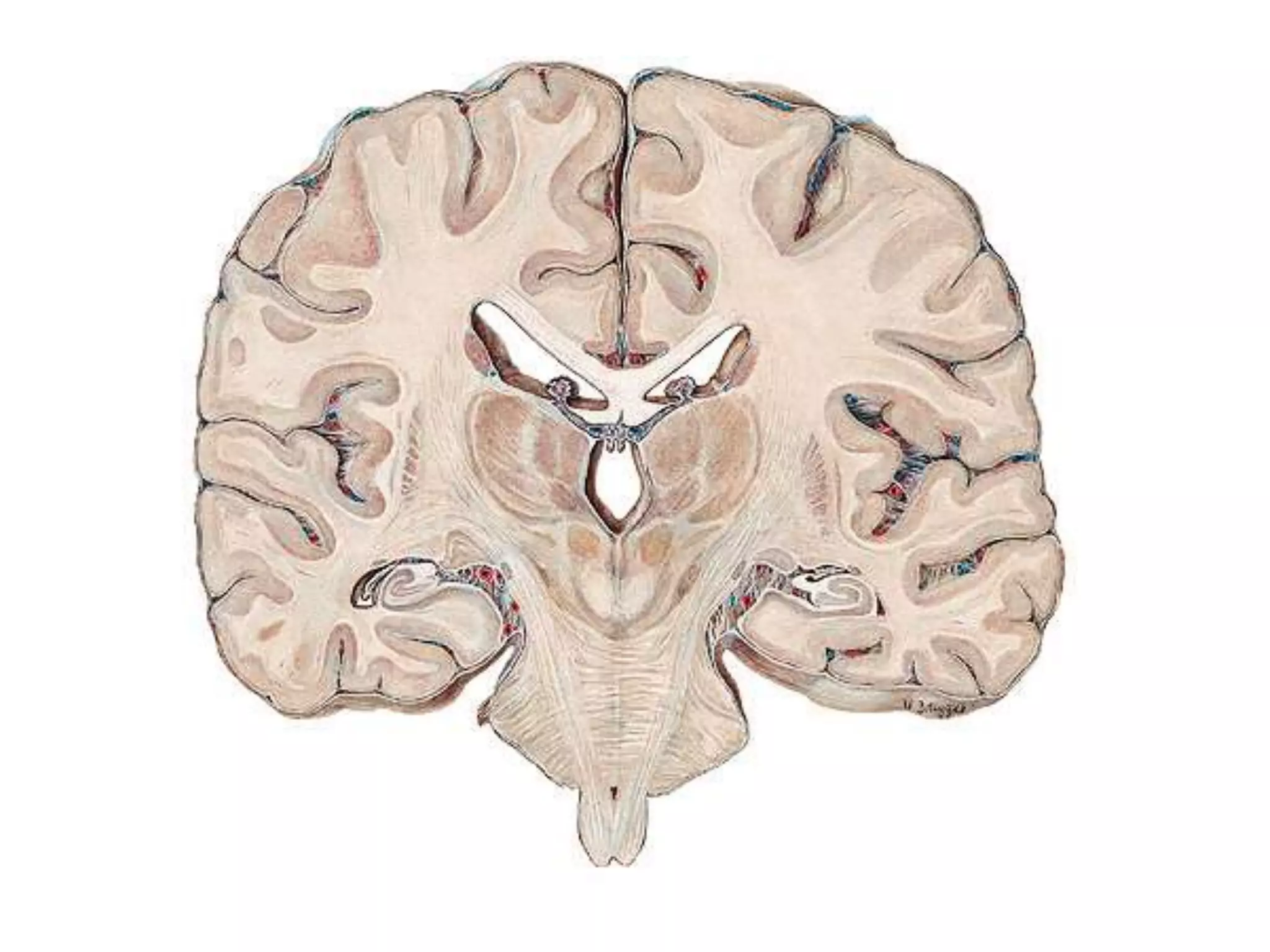 Laminas de cortes (coronal)del encefalo | PPTX | Brain and Nervous ...