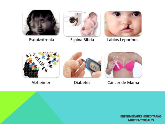 DEFECTOS TRANSMITIDOS POR HERENCIA MULTIFACTORIAL