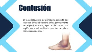Lesiones traumáticas. Contusión, esguince y luxación | PPTX
