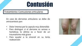 Lesiones traumáticas. Contusión, esguince y luxación | PPTX