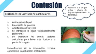 Lesiones traumáticas. Contusión, esguince y luxación | PPTX