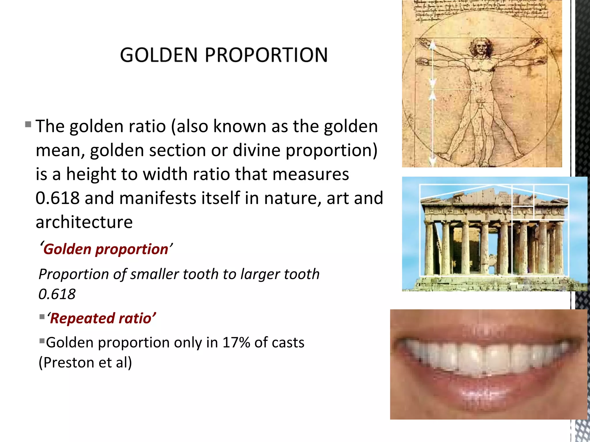 Dental Veneers & Laminates | PPT