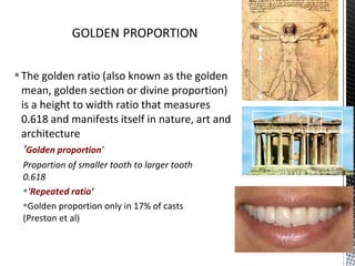 Dental Veneers & Laminates | PPT