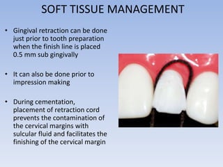LAMINATES VENEERS.pptx