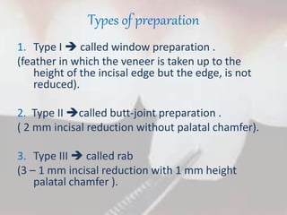 Laminate veneer. | PPTX