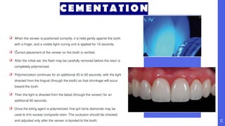 LAMINATE and VENEERS in Prosthodontics.pptx