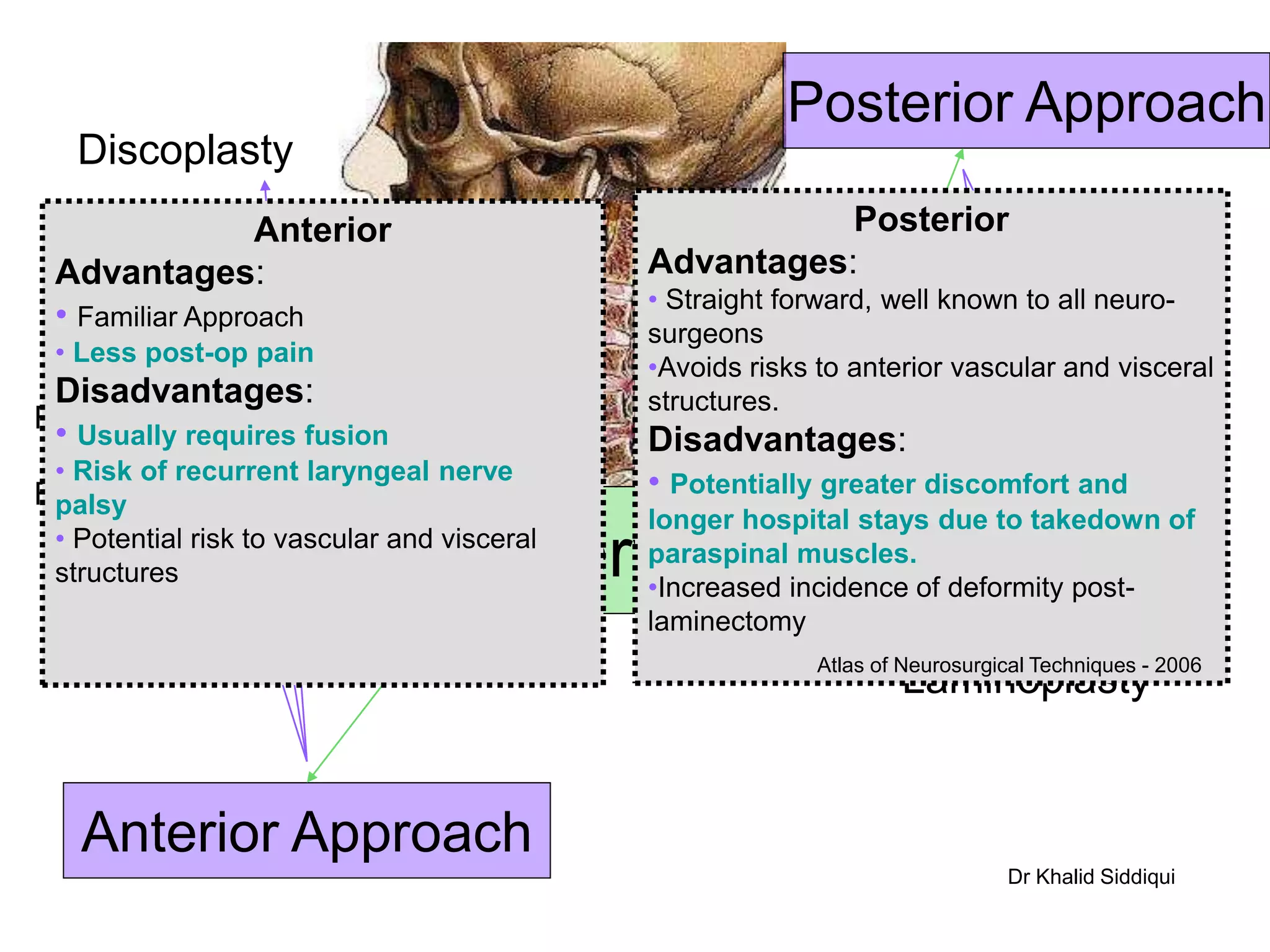 Laminectomy vs Discectomy in Rehabilitation | PPT