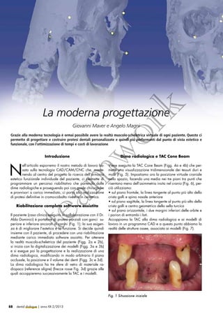 La moderna progettazione dentale | PDF