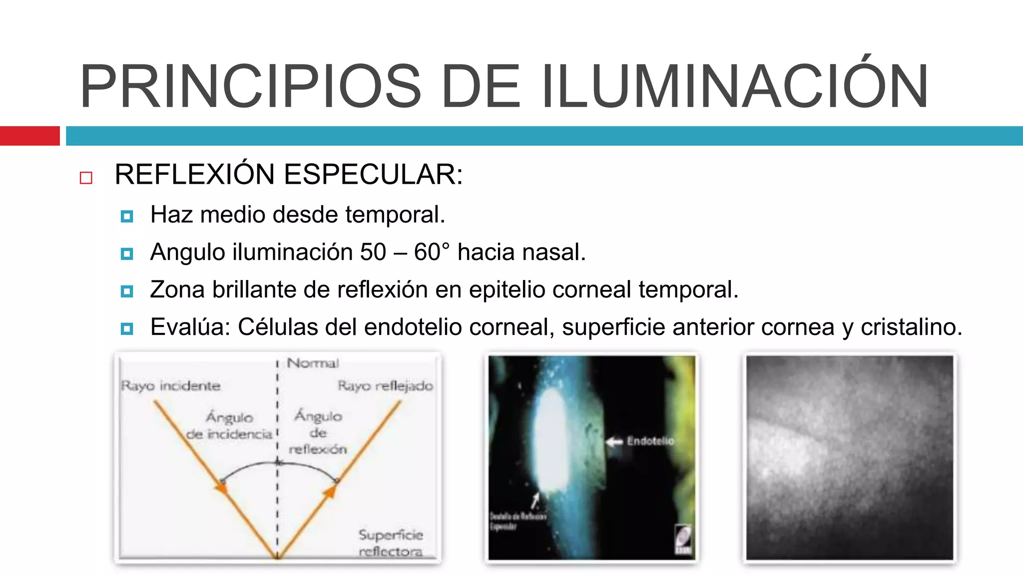 Lampara de hendidura | PPTX