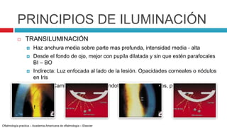 Lampara de hendidura | PPTX