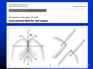 La mucoprolassectomia sec. longo in day surgery | PPT