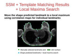 Landmark detection using statistical shape modelling and template ...