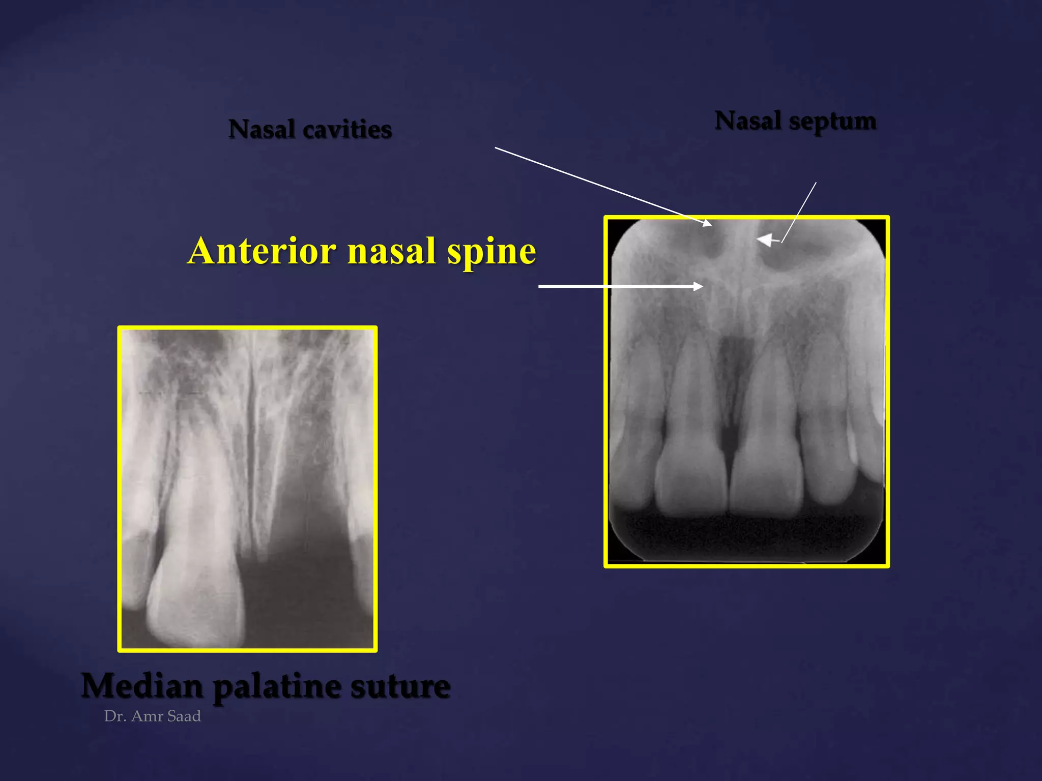 anatomical Landmarks | PPTX