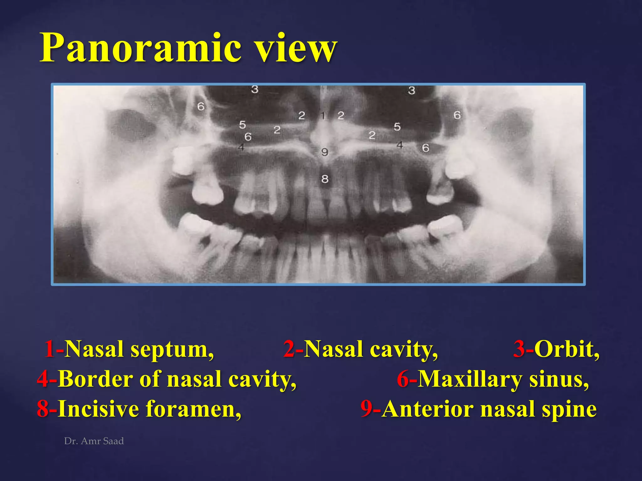 anatomical Landmarks | PPTX