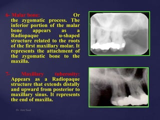 anatomical Landmarks | PPTX