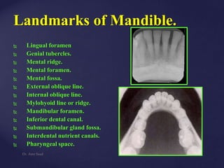 Genial Tubercles Xray