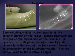Internal Oblique Ridge Radiograph