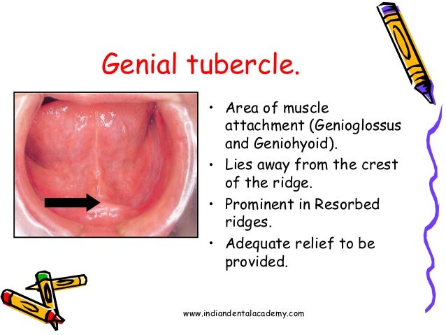 Land marks / dental implant courses by Indian dental academy