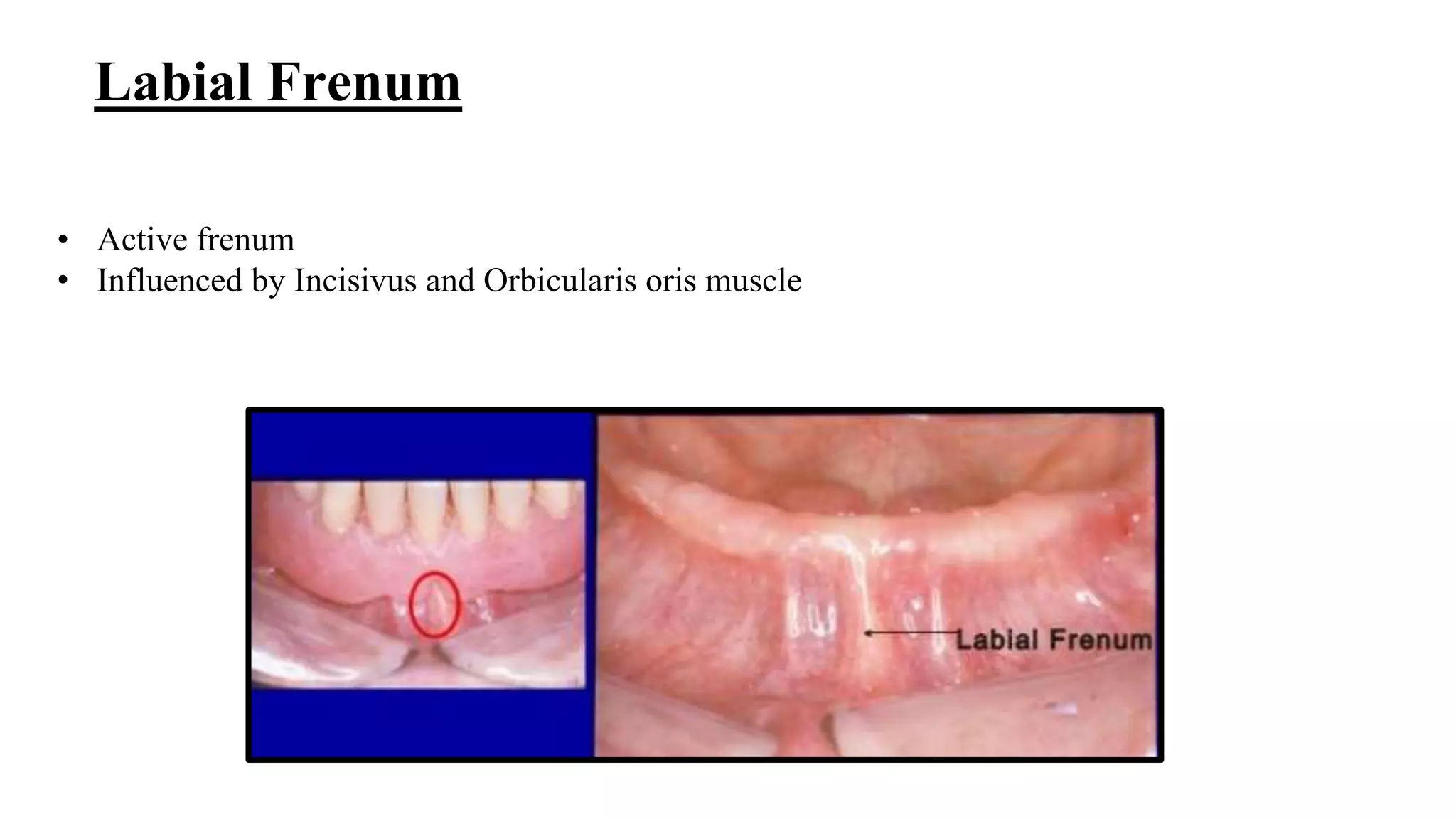 Landmarks of mandible | PPTX